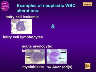 CBC Part 2 - WBC Differential & Morphology (2).pptx
