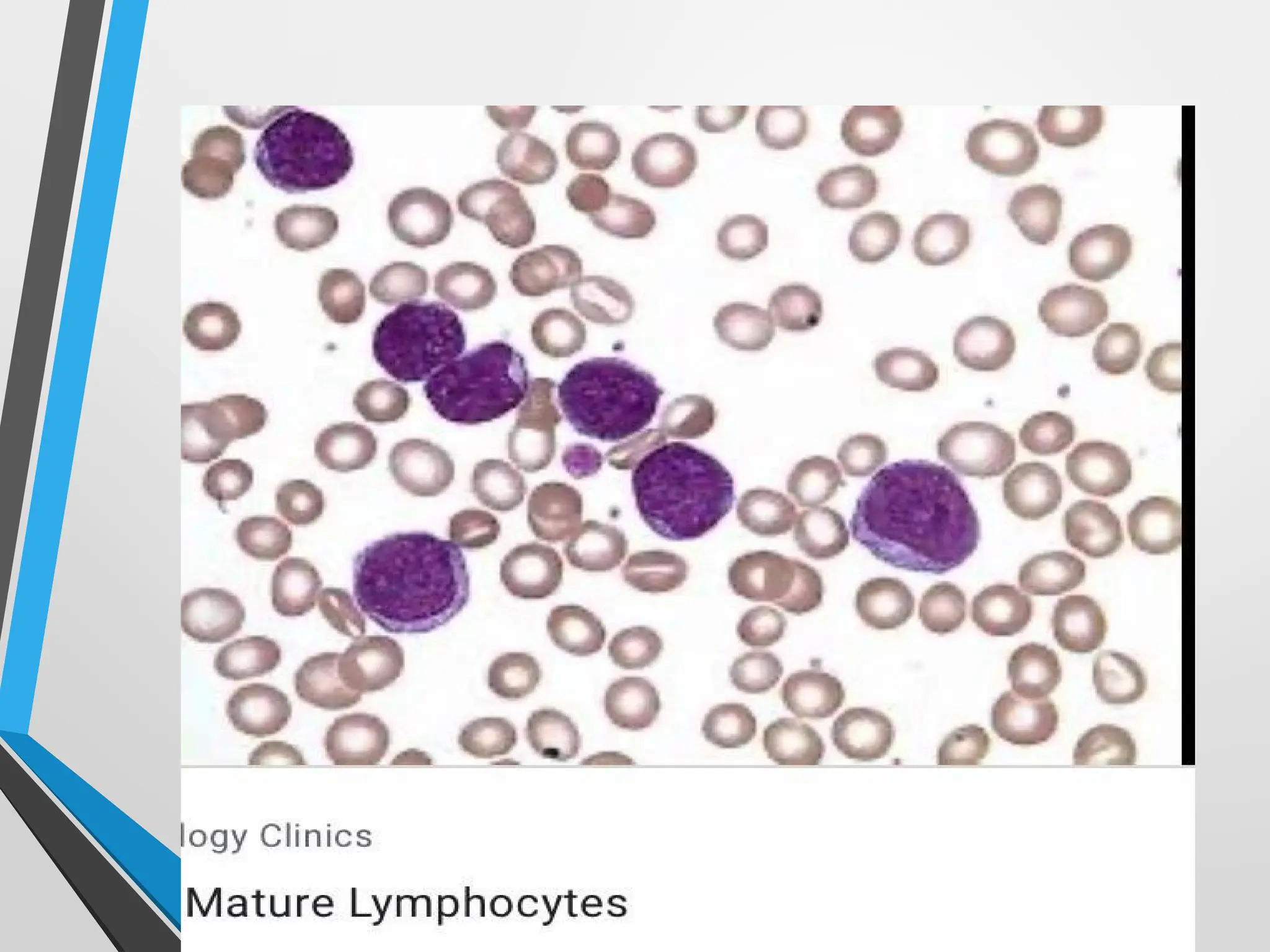 cbc presentation.pptx blood lab analysis | PPTX