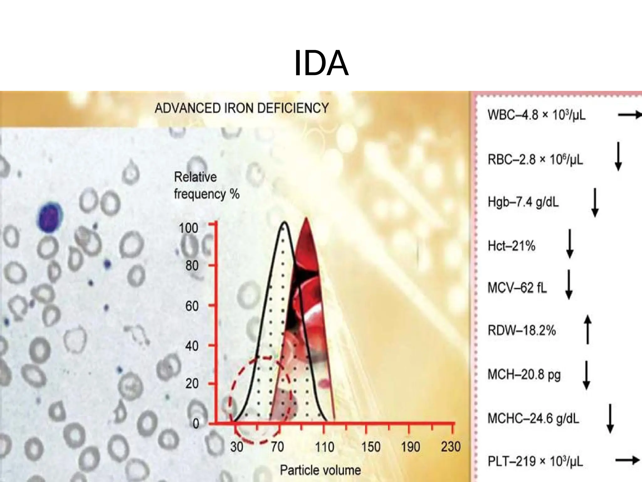 CBC, Principle of Cell Counter, Interpretation of Histogram ...