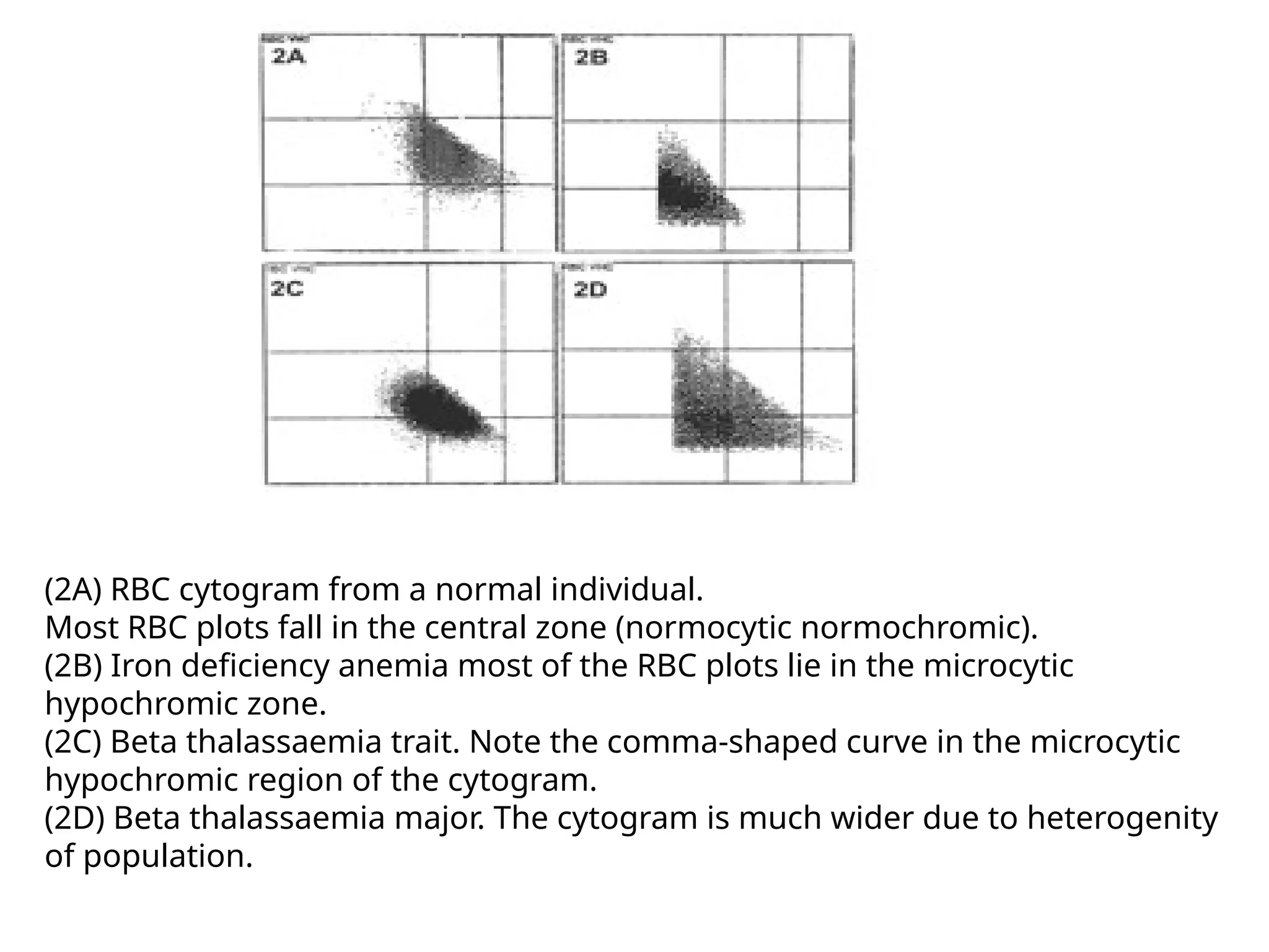 CBC, Principle of Cell Counter, Interpretation of Histogram ...
