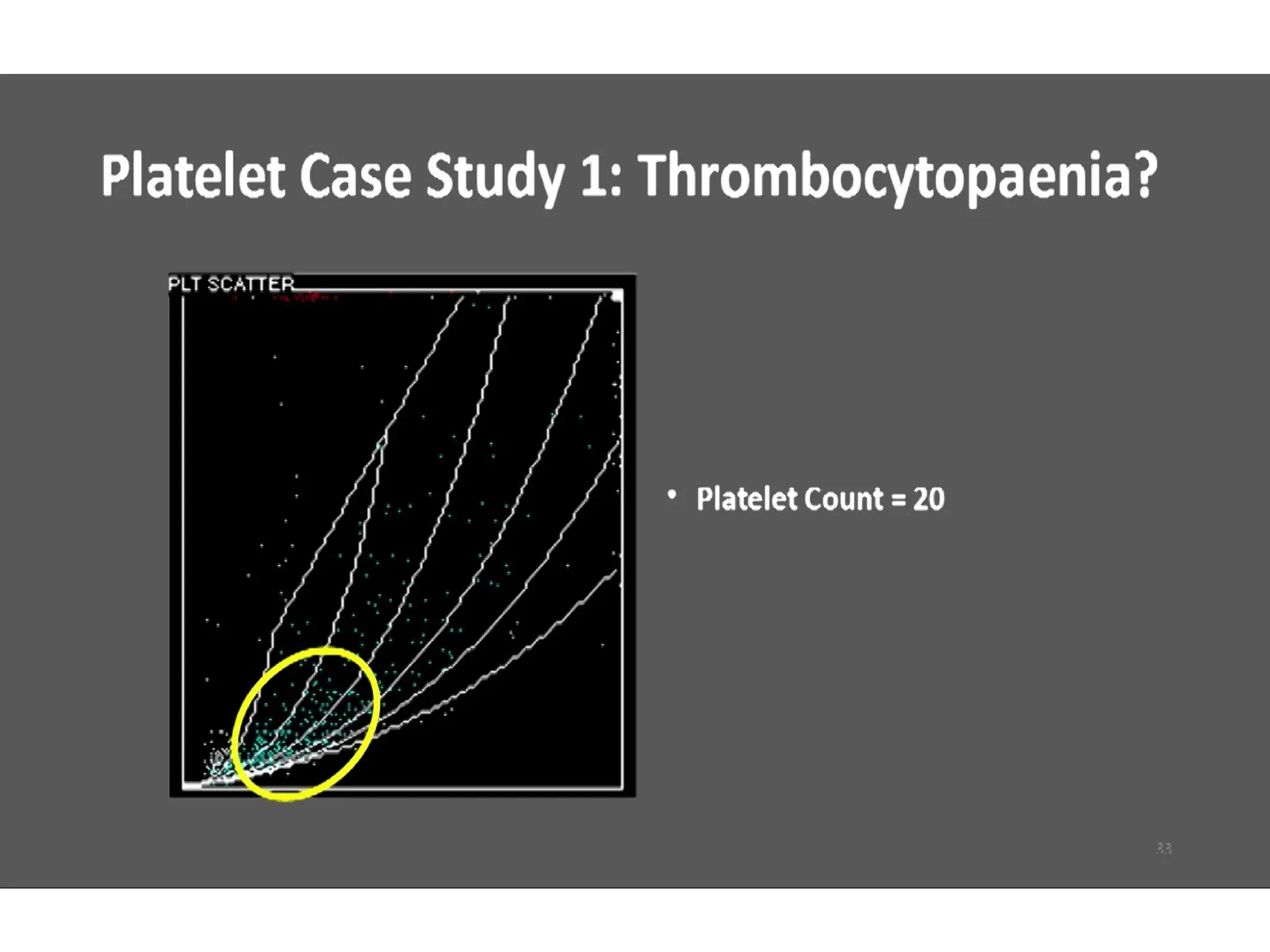 CBC, Principle of Cell Counter, Interpretation of Histogram ...