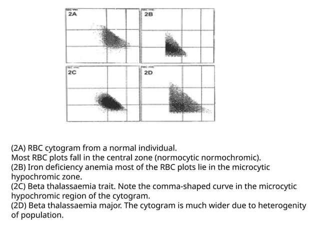 CBC, Principle of Cell Counter, Interpretation of Histogram ...