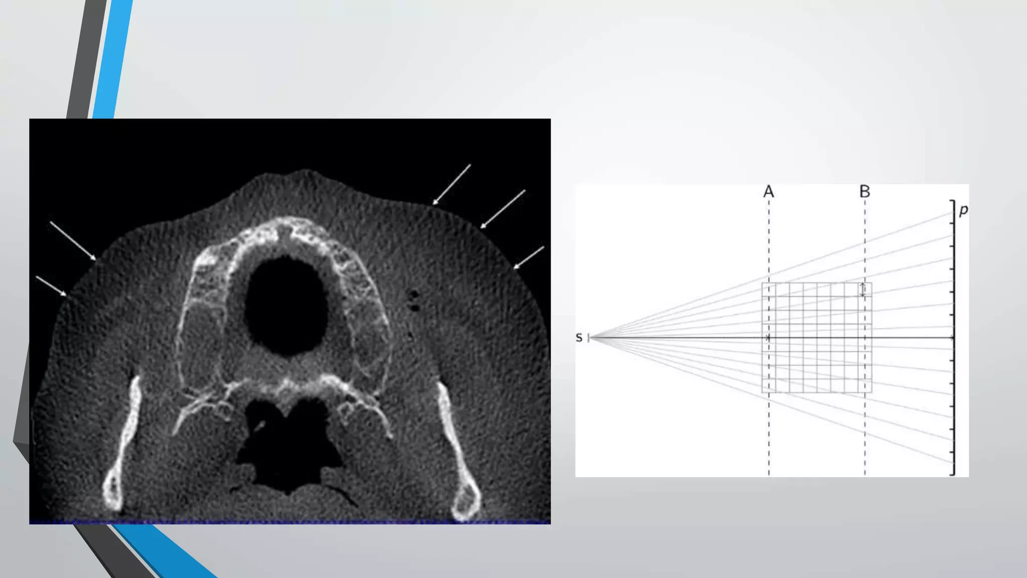 Cbct | PPTX