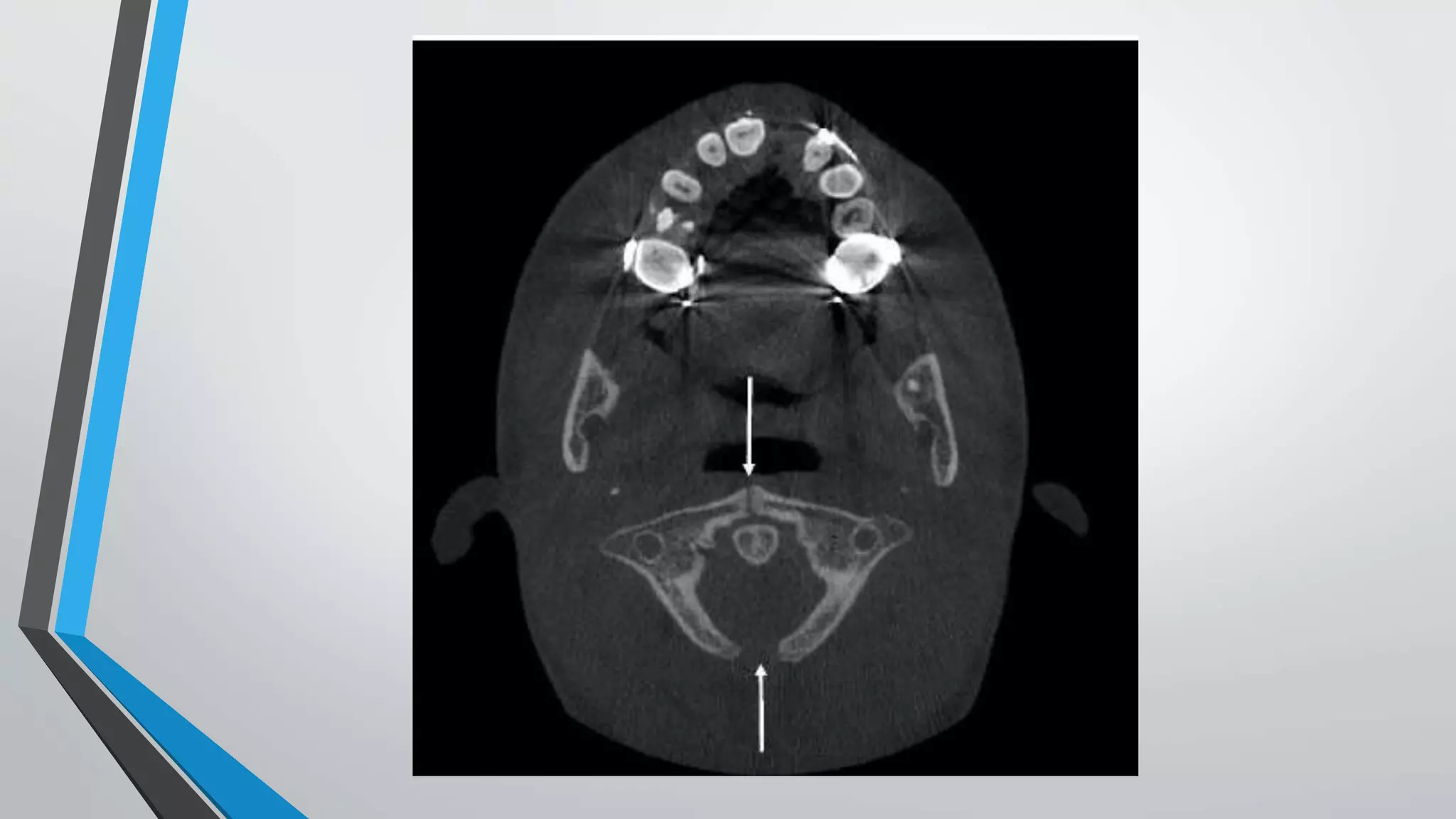 Cbct | PPTX