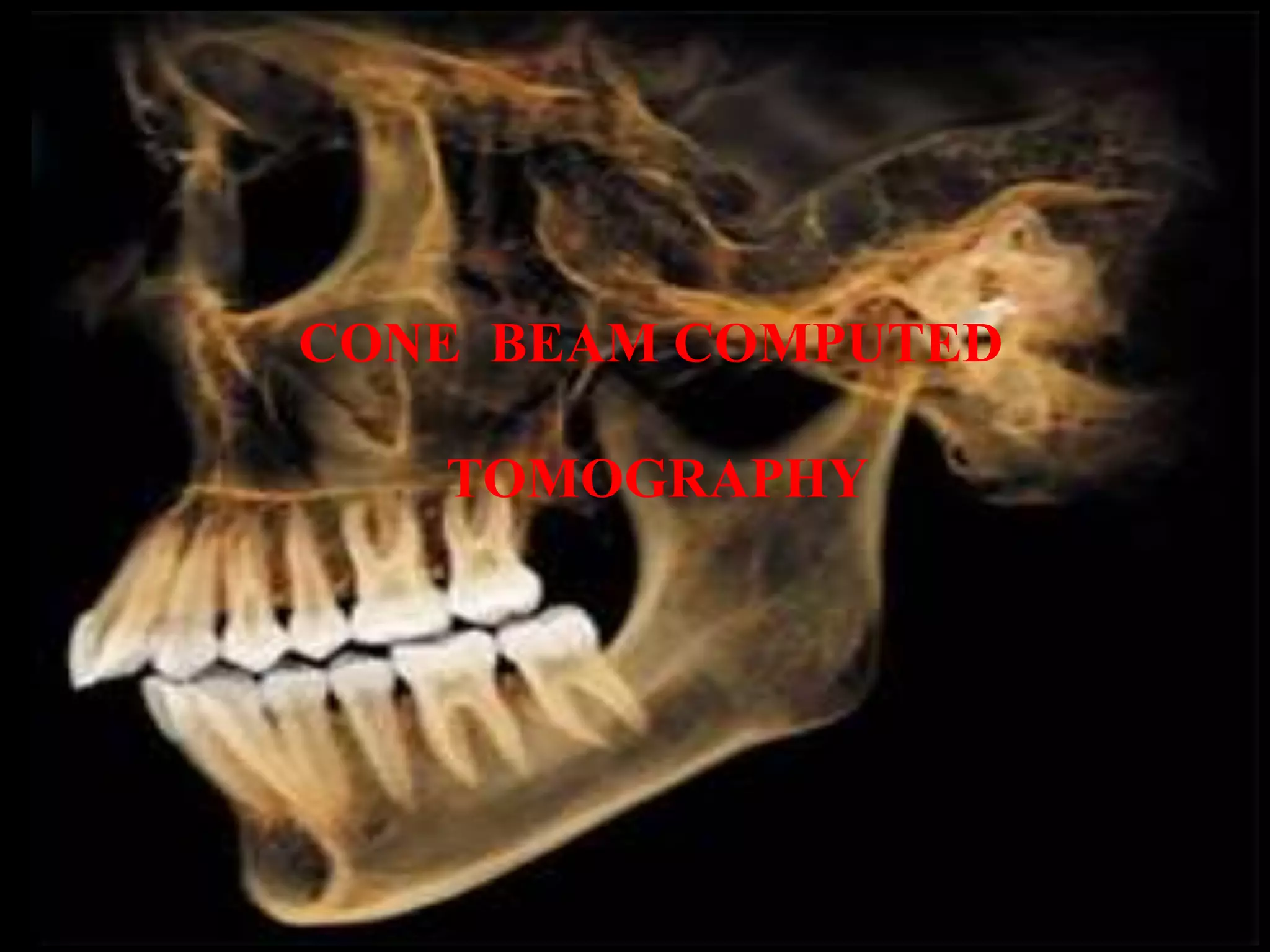 Cbct | PPTX