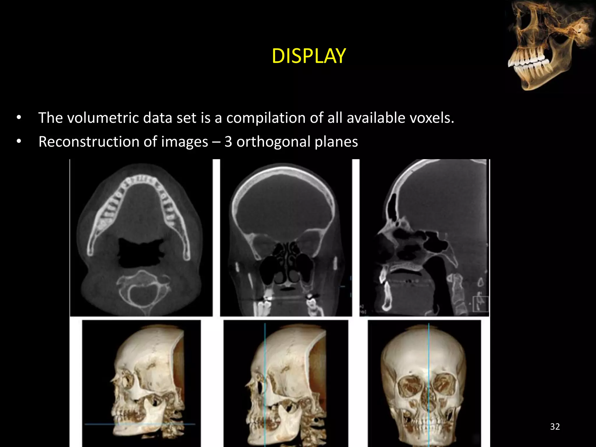 Cbct | PPTX