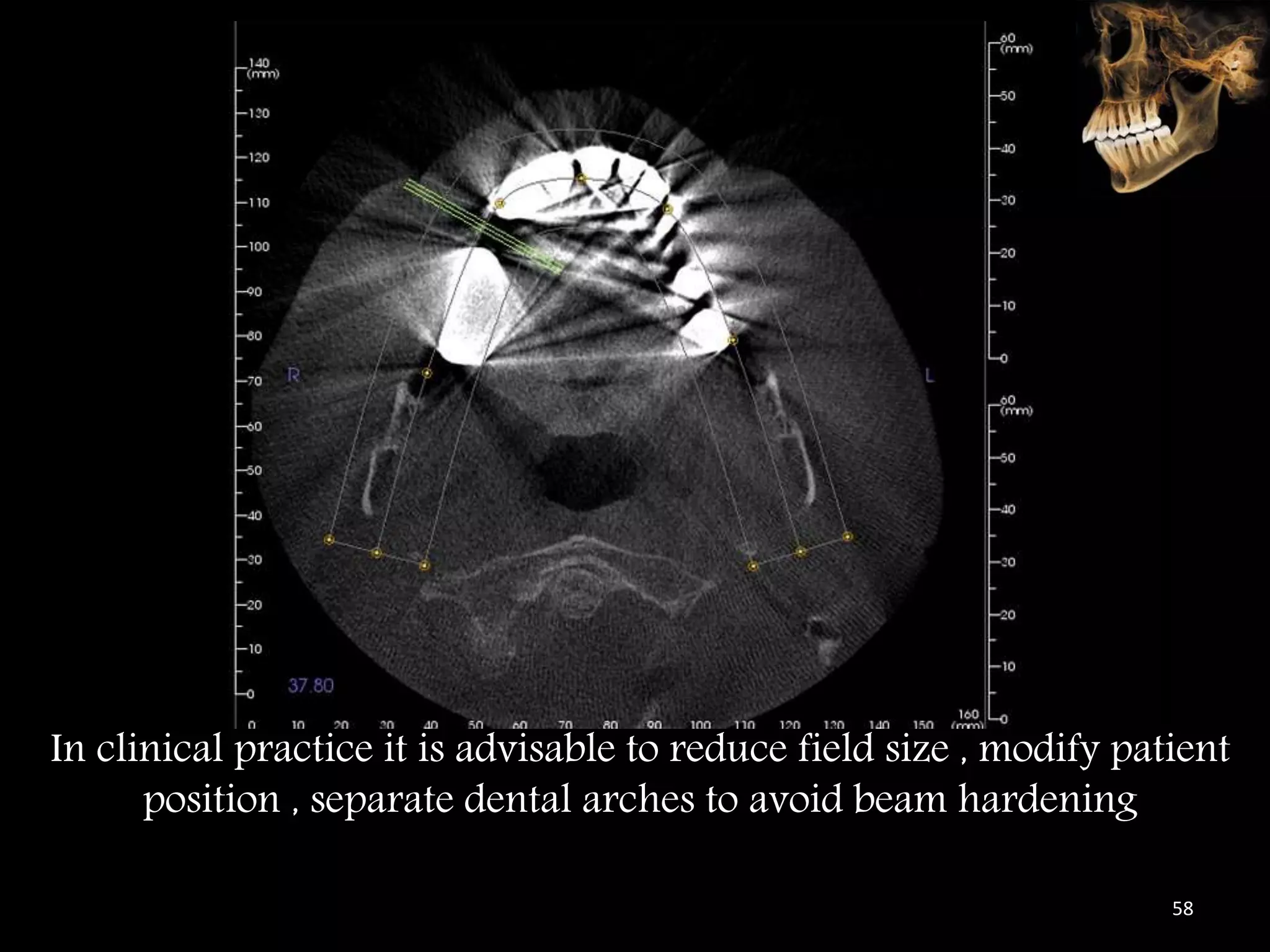 Cbct | PPTX