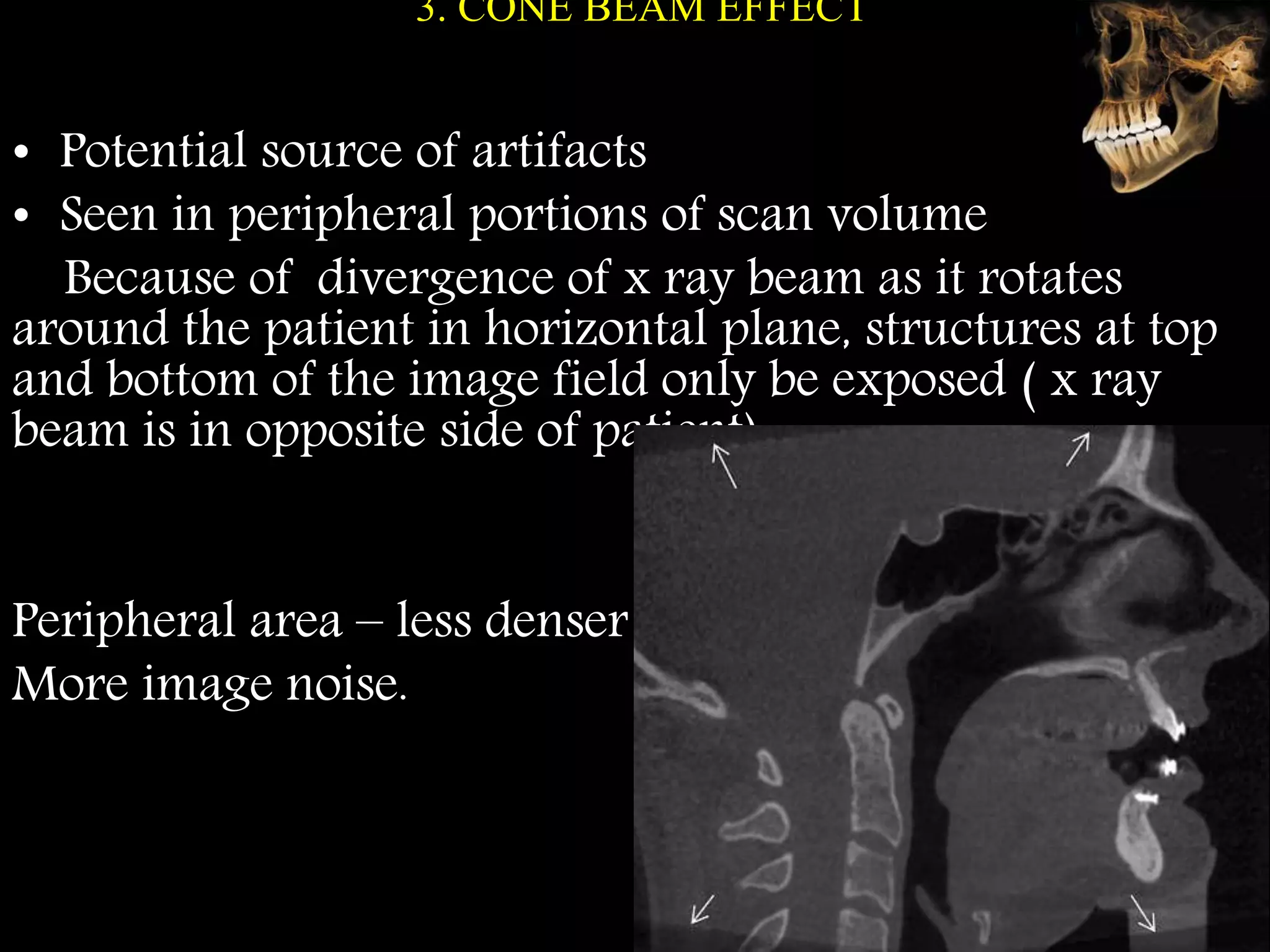 Cbct | PPTX