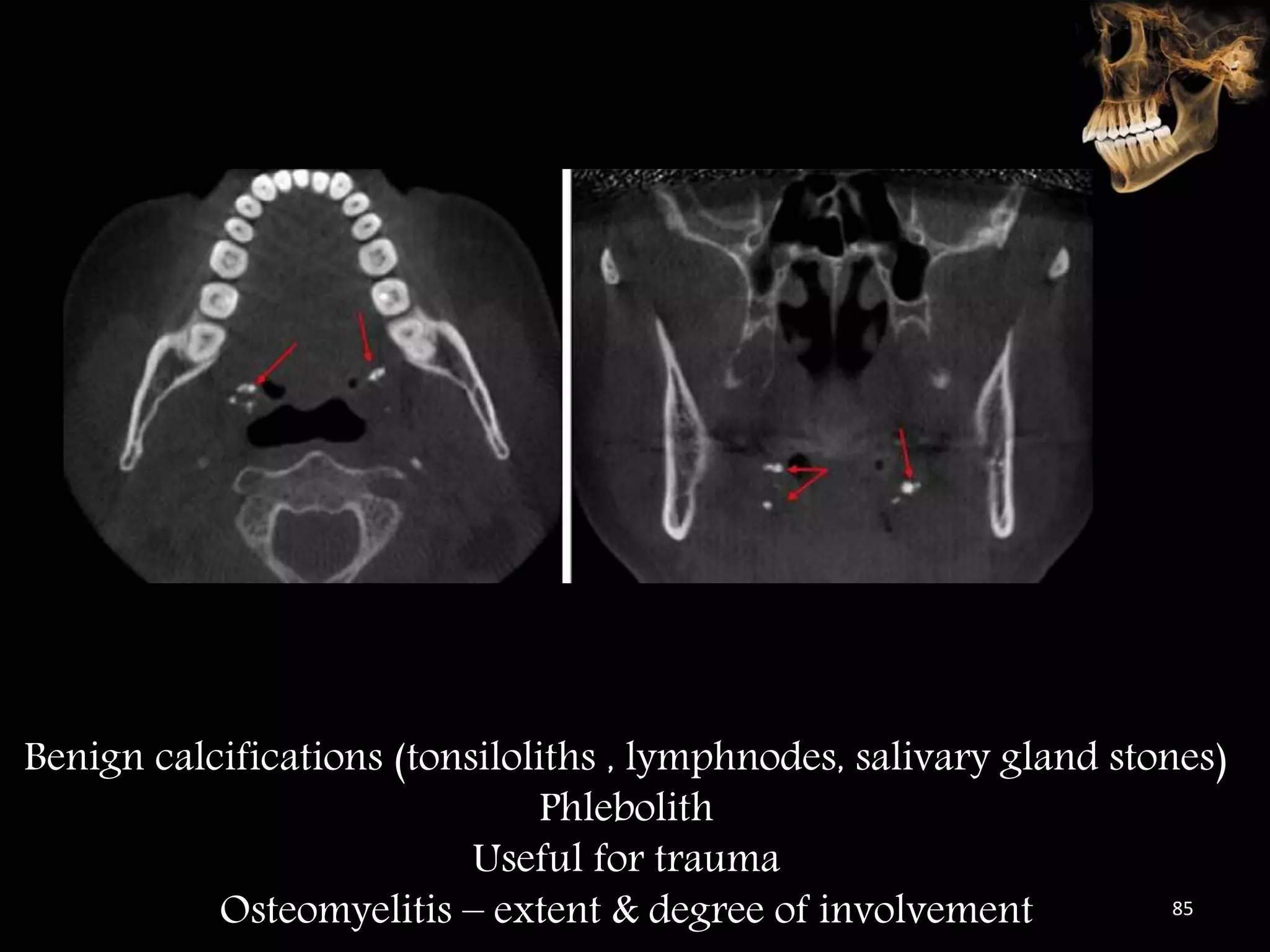 Cbct | PPTX