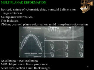 Cbct | PPTX