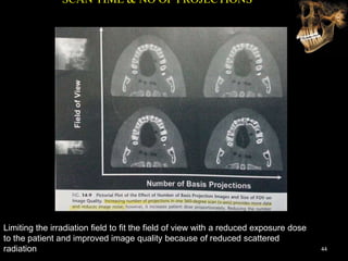 Cbct | PPTX
