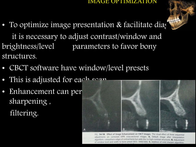 Cbct | PPTX