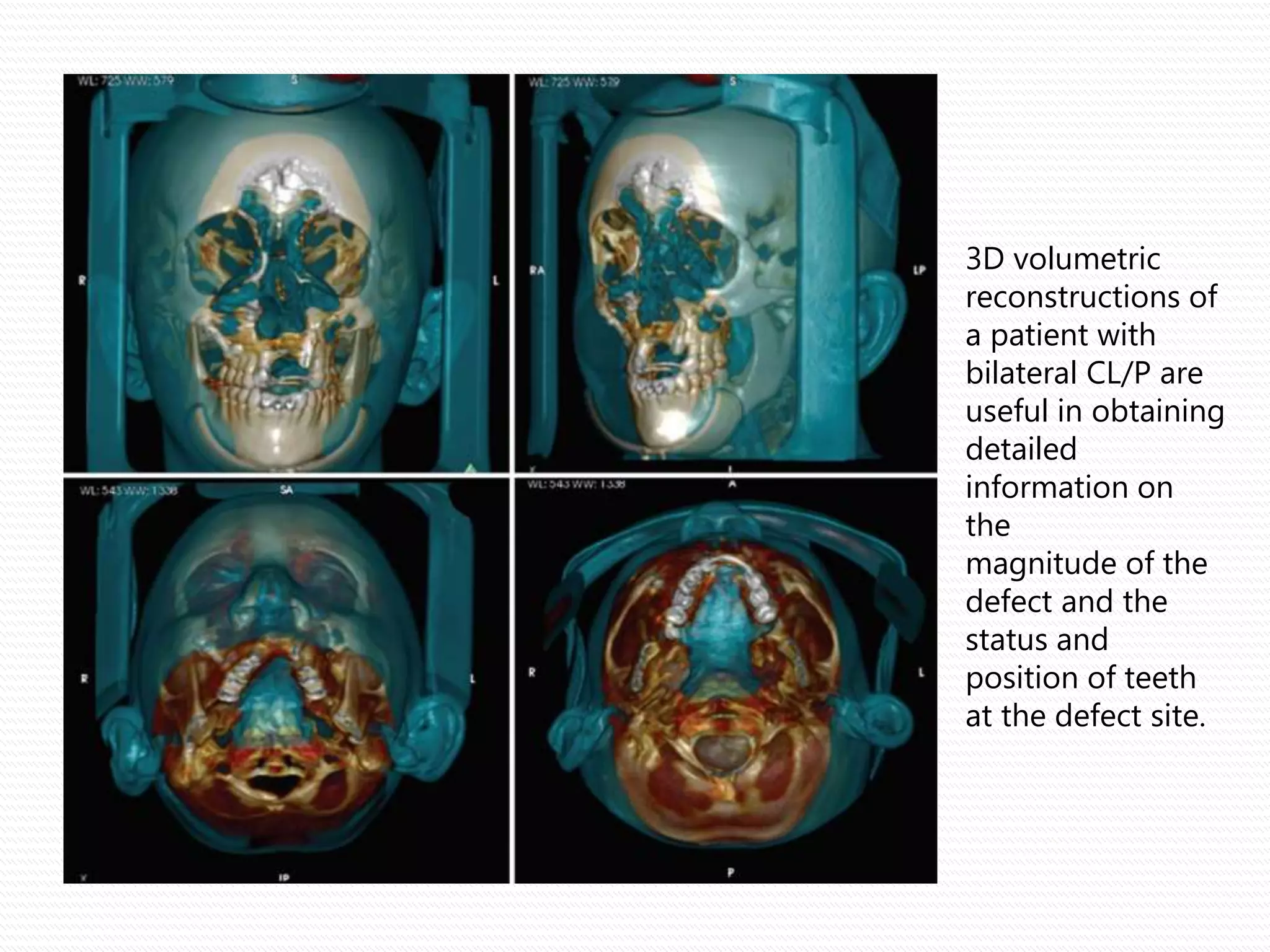 CBCT IN ORTHODONTICS | PPTX