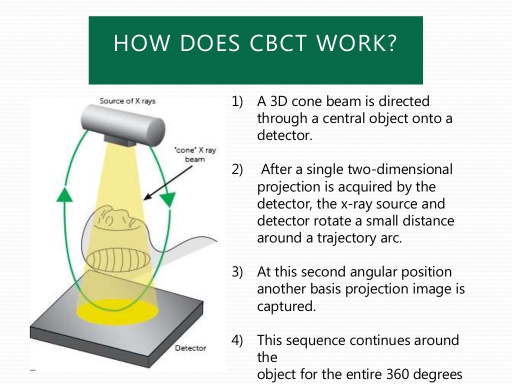CBCT IN ORTHODONTICS