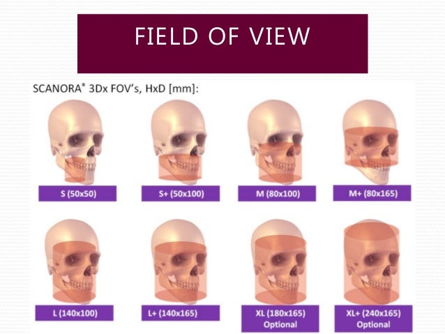 CBCT IN ORTHODONTICS