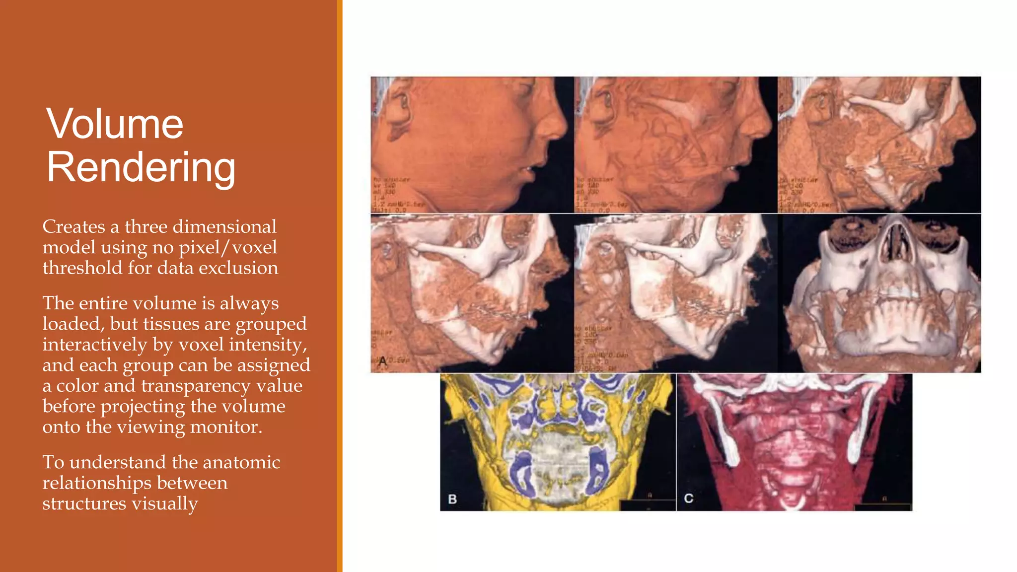 CBCT IN ORTHODONTICS | PPTX