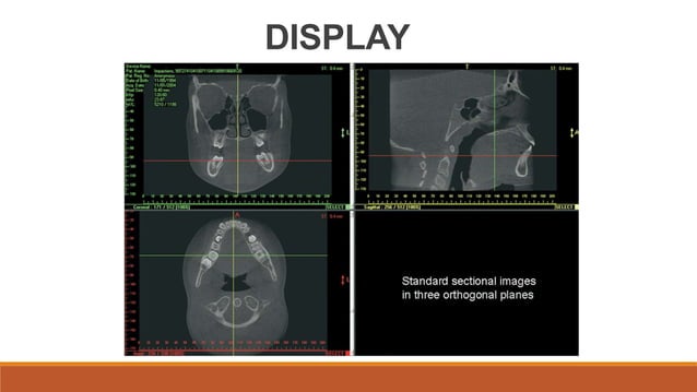CBCT IN ORTHODONTICS | PPTX | 3-D Graphics | Computer Software and ...