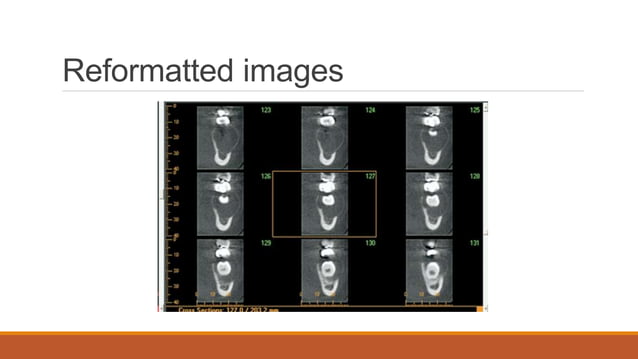 CBCT IN ORTHODONTICS | PPTX | 3-D Graphics | Computer Software and ...