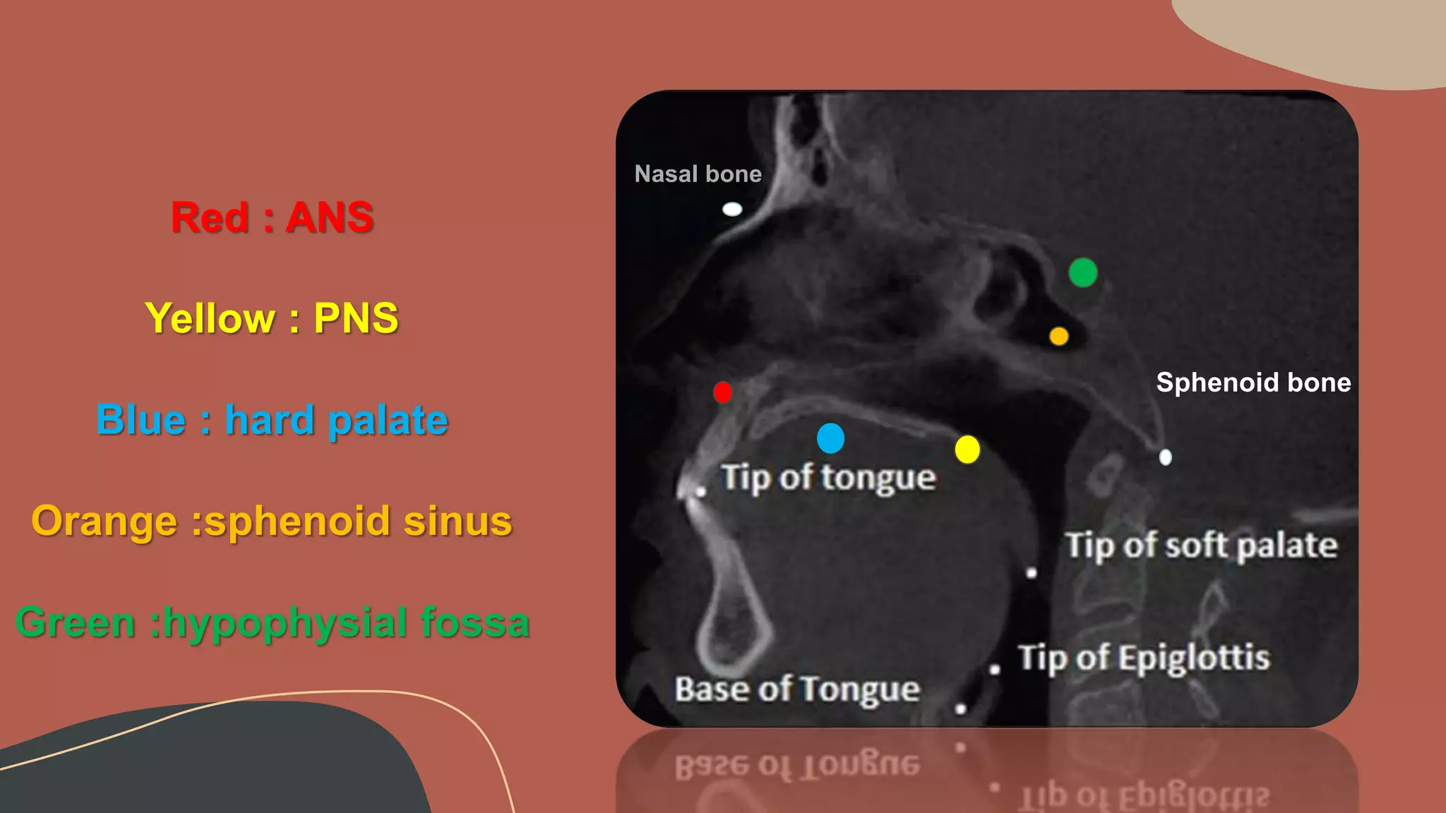 CBCT anatomical structures.pptx