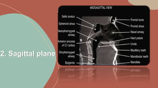 CBCT anatomical structures.pptx