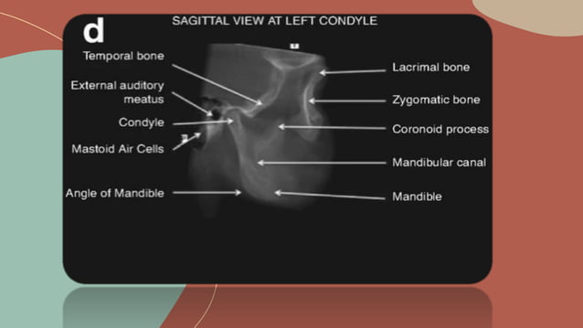 CBCT anatomical structures.pptx