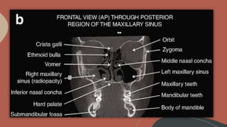 CBCT anatomical structures.pptx