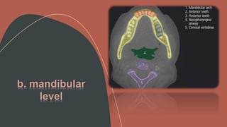 CBCT anatomical structures.pptx