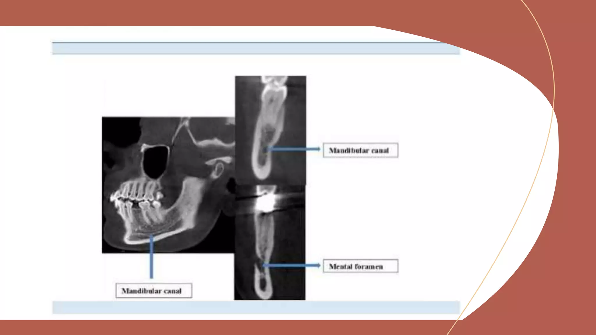 CBCT anatomical structures | PPTX