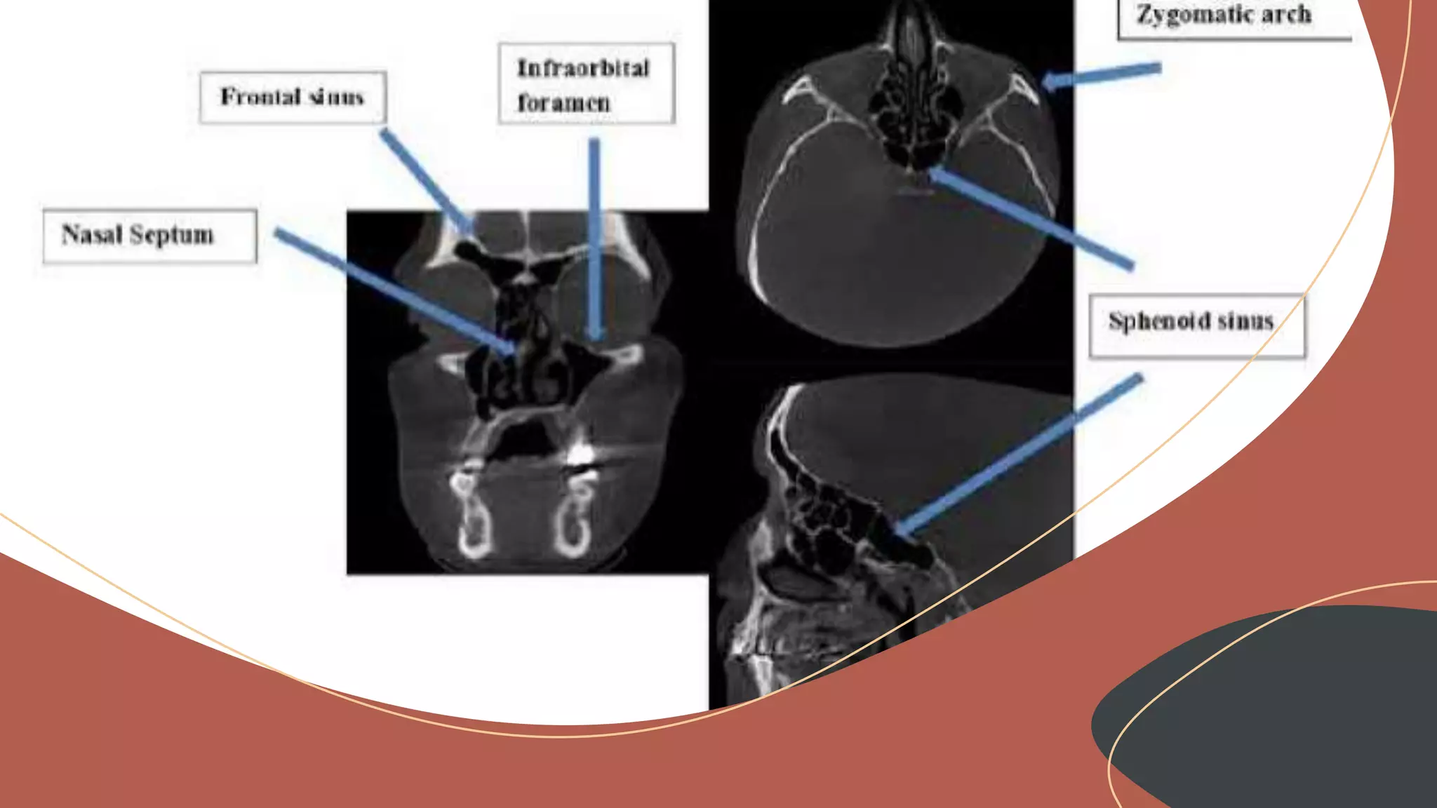 CBCT anatomical structures | PPTX
