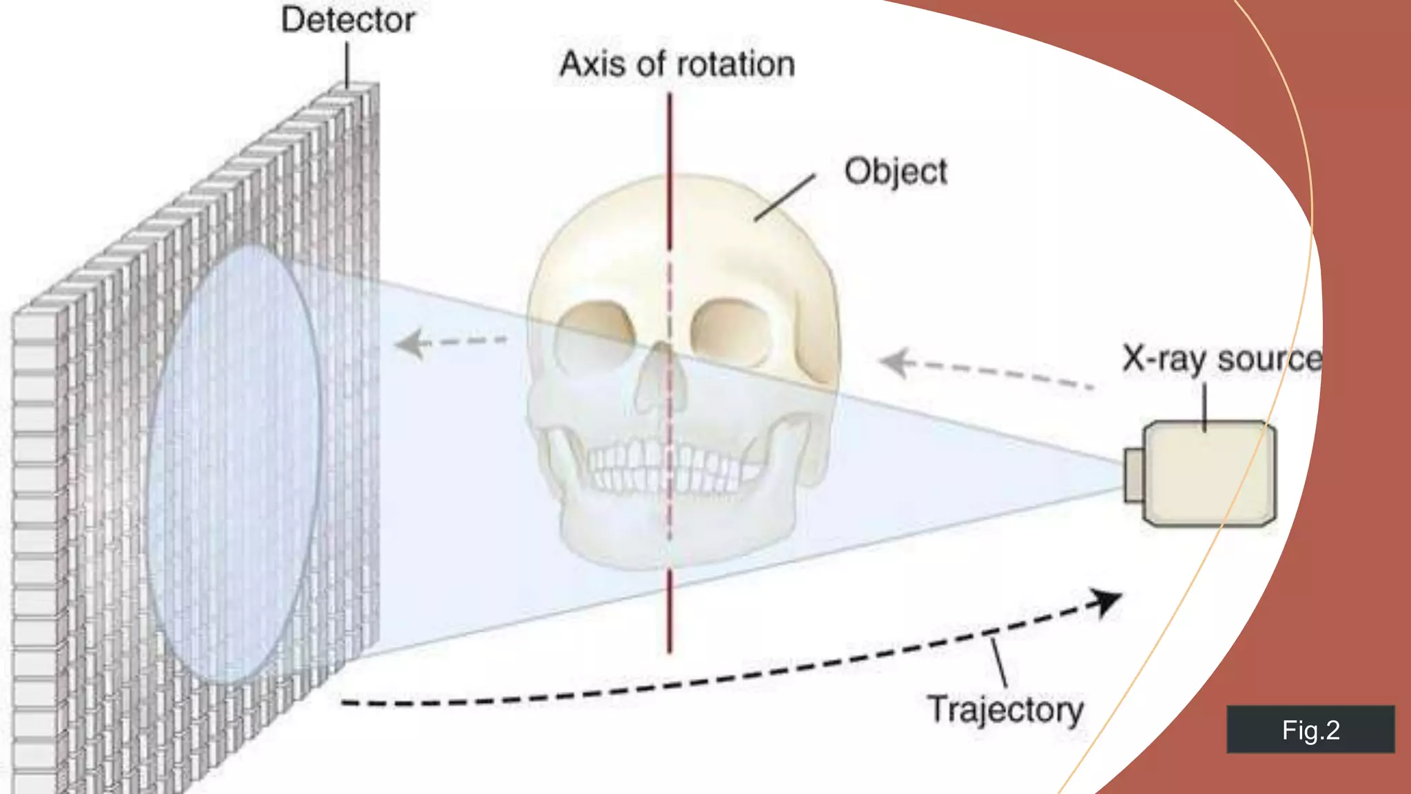 CBCT anatomical structures | PPTX