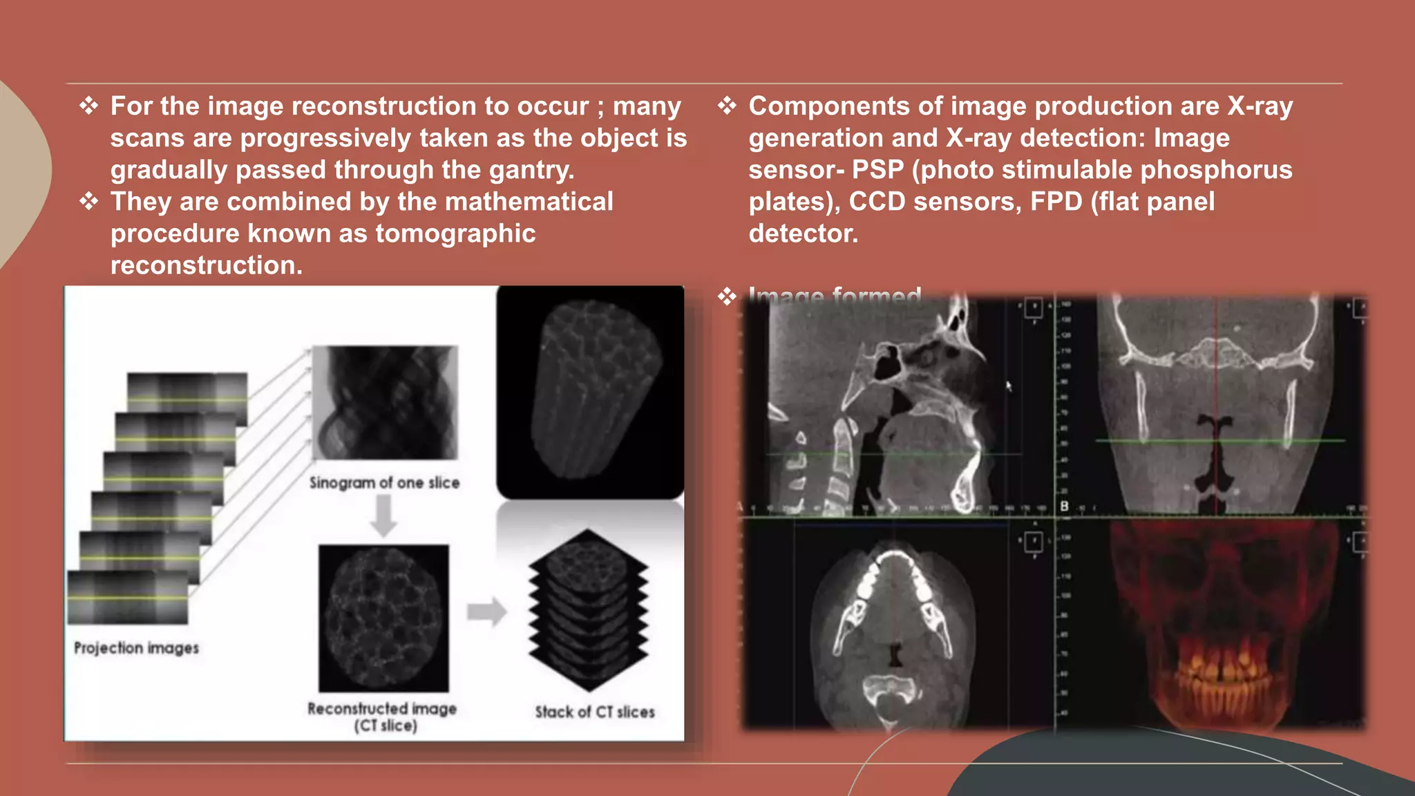 CBCT anatomical structures | PPTX