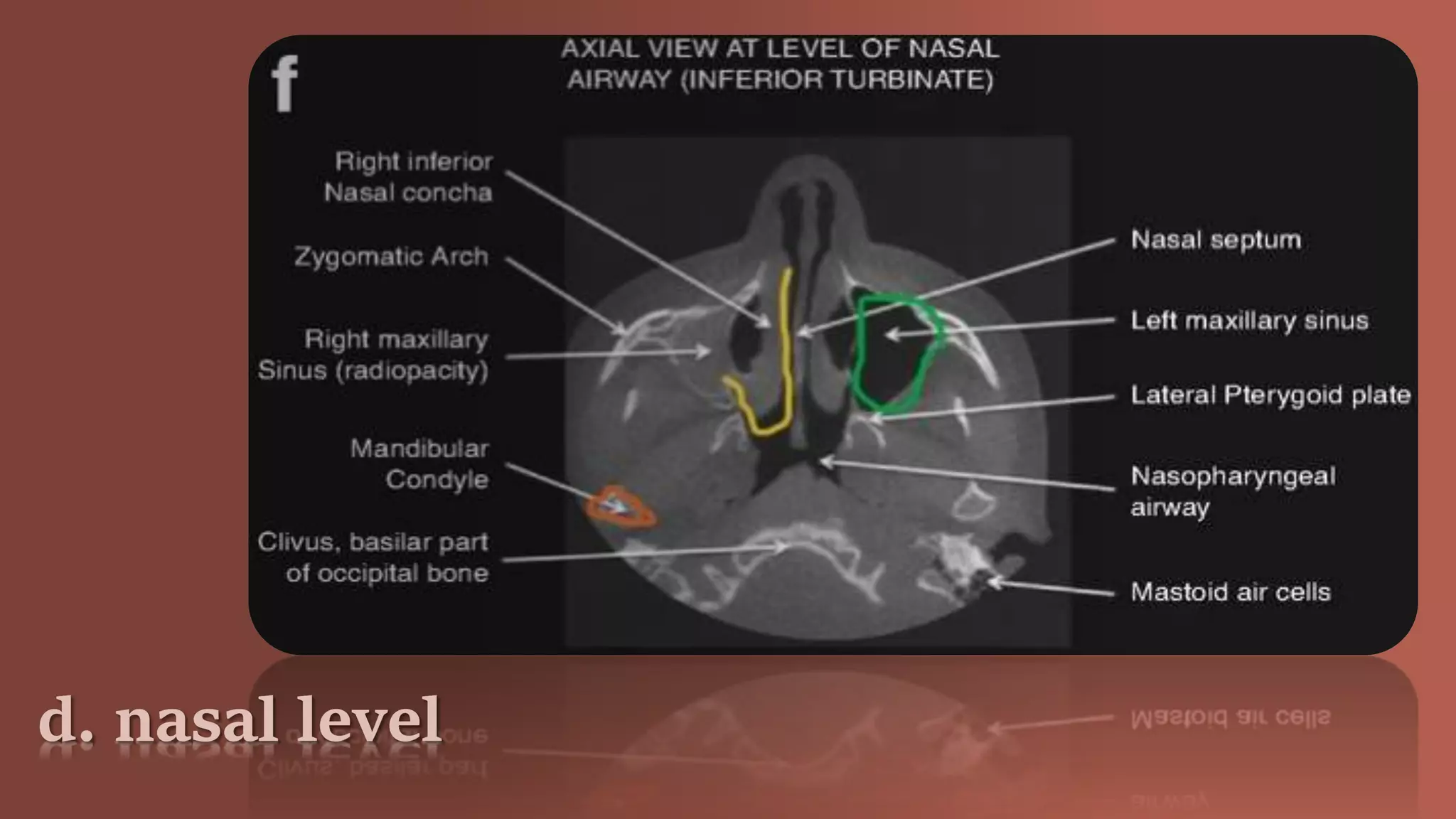 CBCT anatomical structures | PPTX