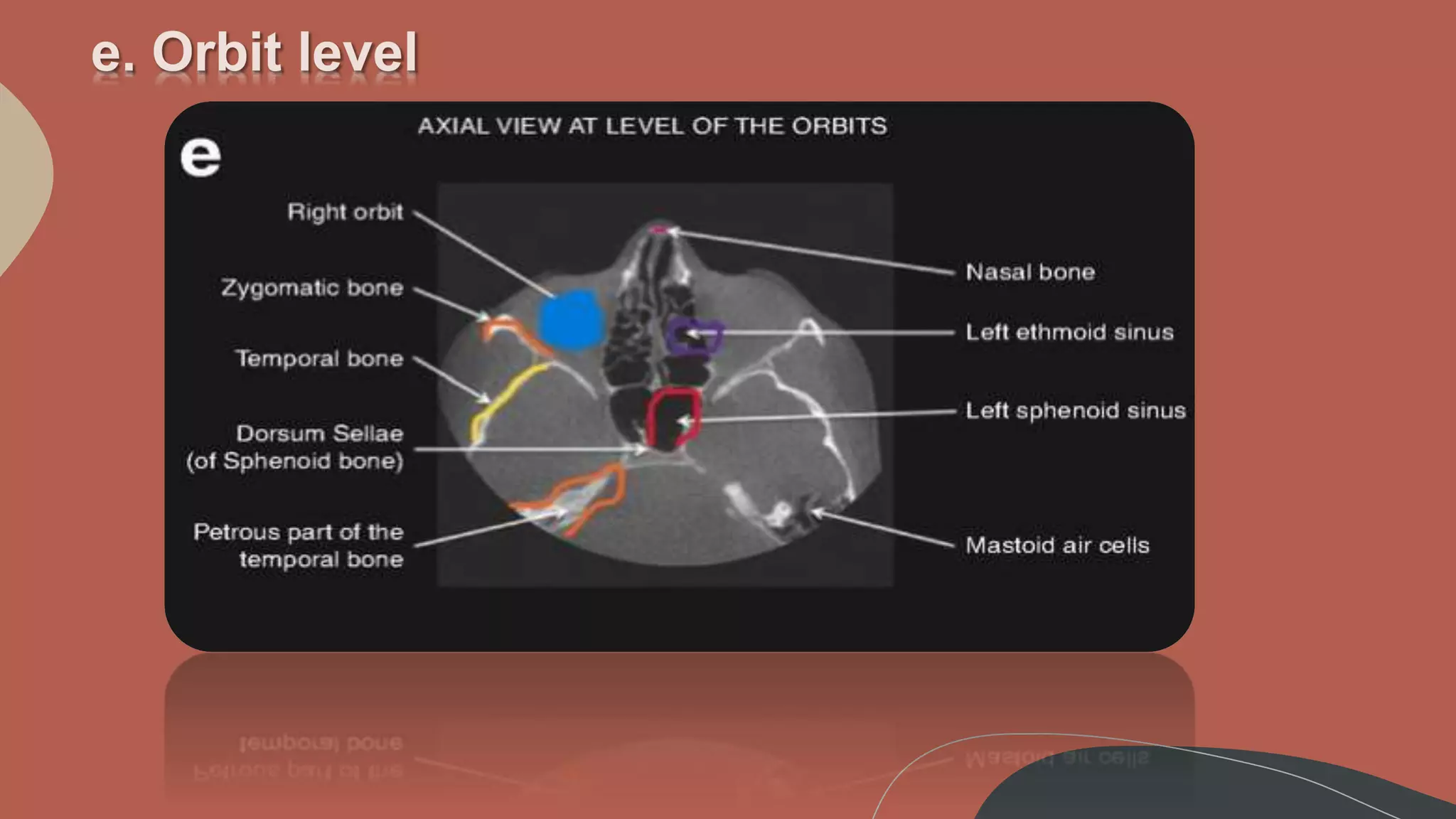 CBCT anatomical structures | PPTX