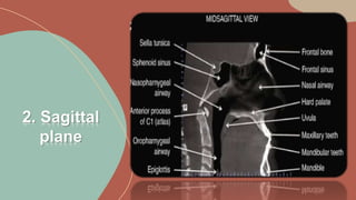 CBCT anatomical structures | PPTX