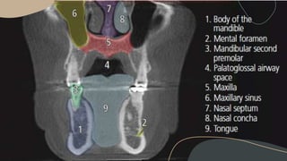 CBCT anatomical structures | PPTX