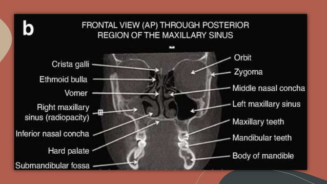 CBCT anatomical structures | PPTX