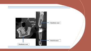 CBCT anatomical structures | PPTX