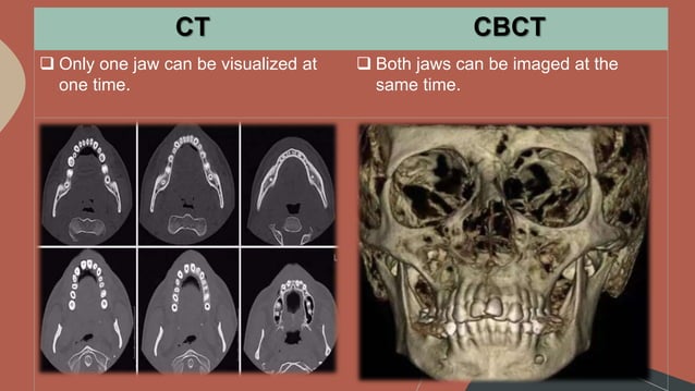 CBCT anatomical structures | PPTX