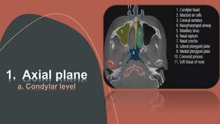 CBCT anatomical structures | PPTX