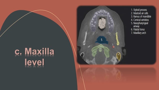 CBCT anatomical structures | PPTX