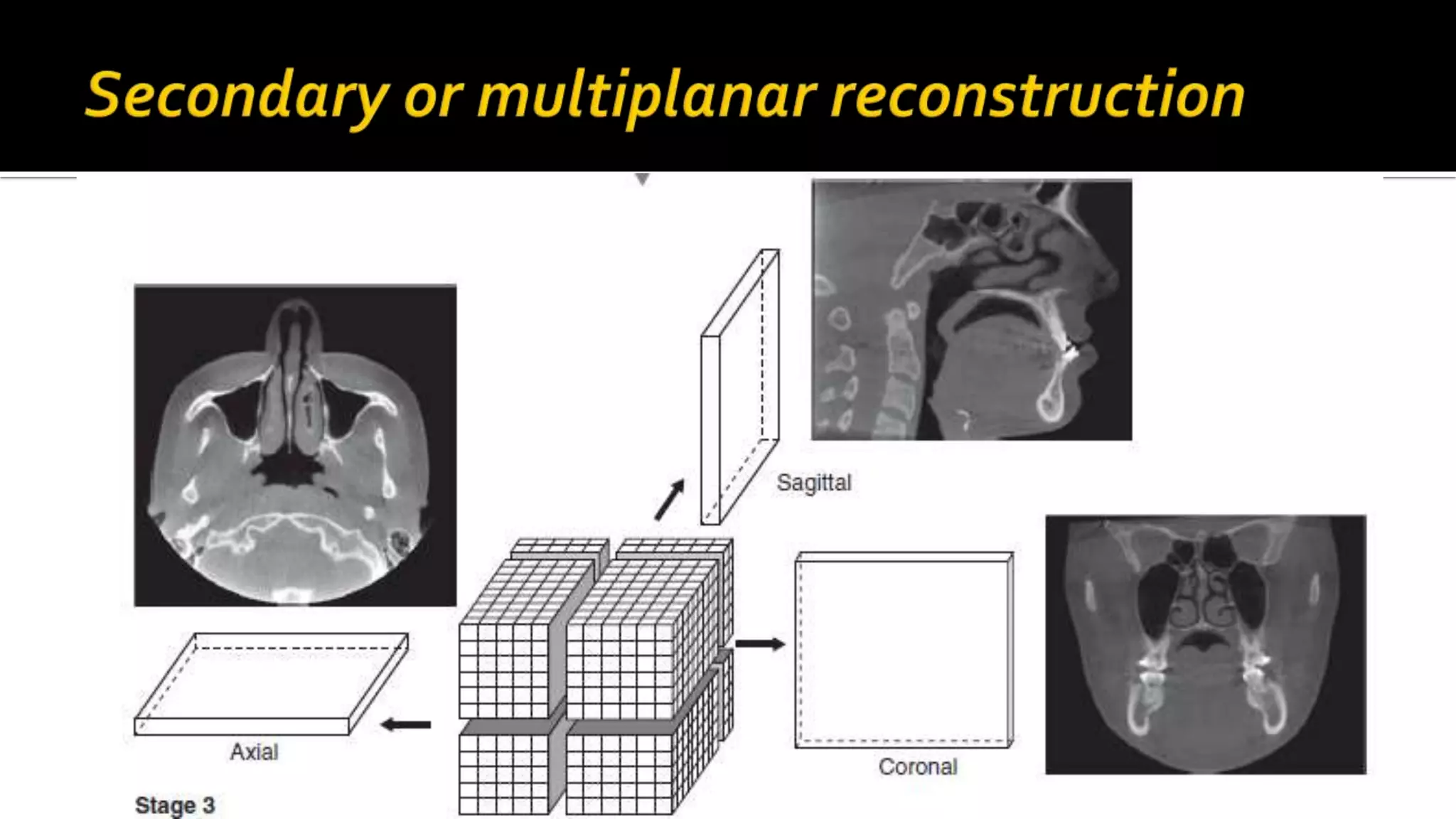 CBCT Basic.pptx