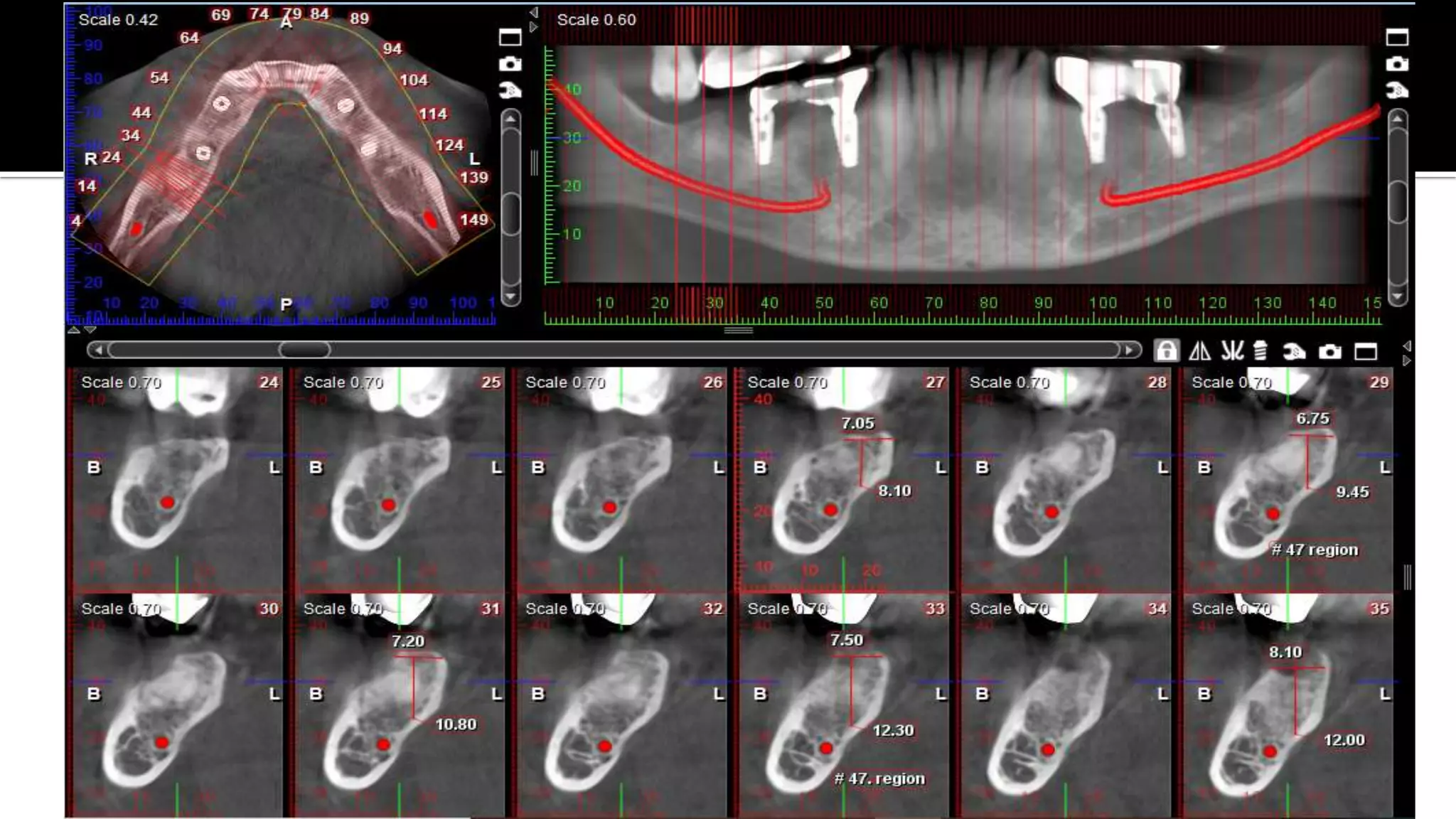CBCT Basic.pptx