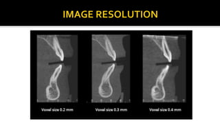 CBCT Basic.pptx