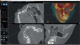 CBCT Basic.pptx