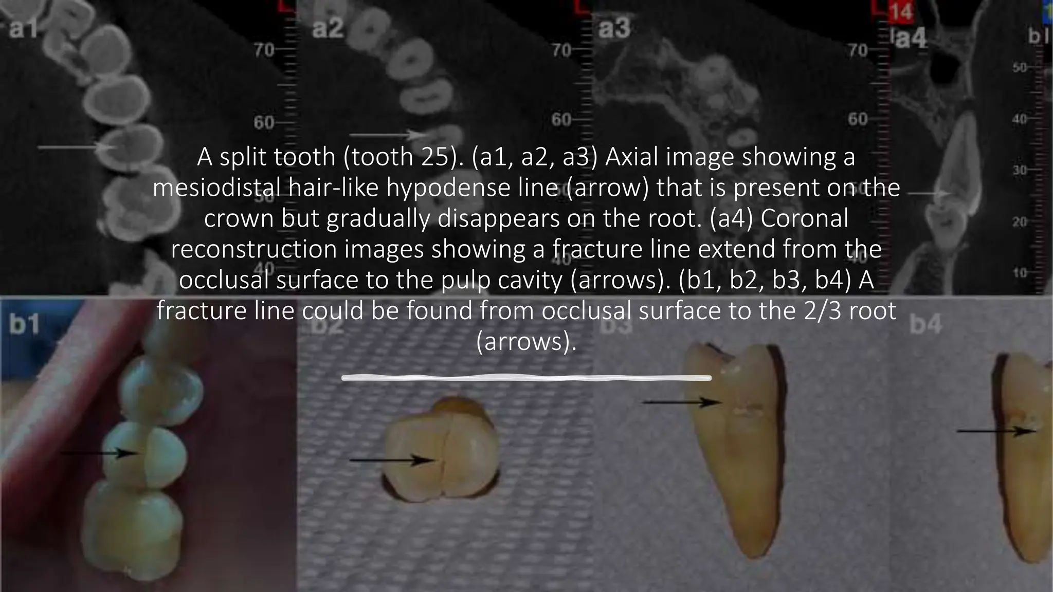 CBCT in dental trauma__.pptx explain dental trauma in cbct | PPTX