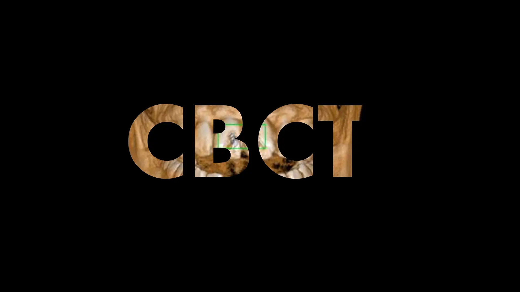 CBCT in dental trauma__.pptx explain dental trauma in cbct | PPTX