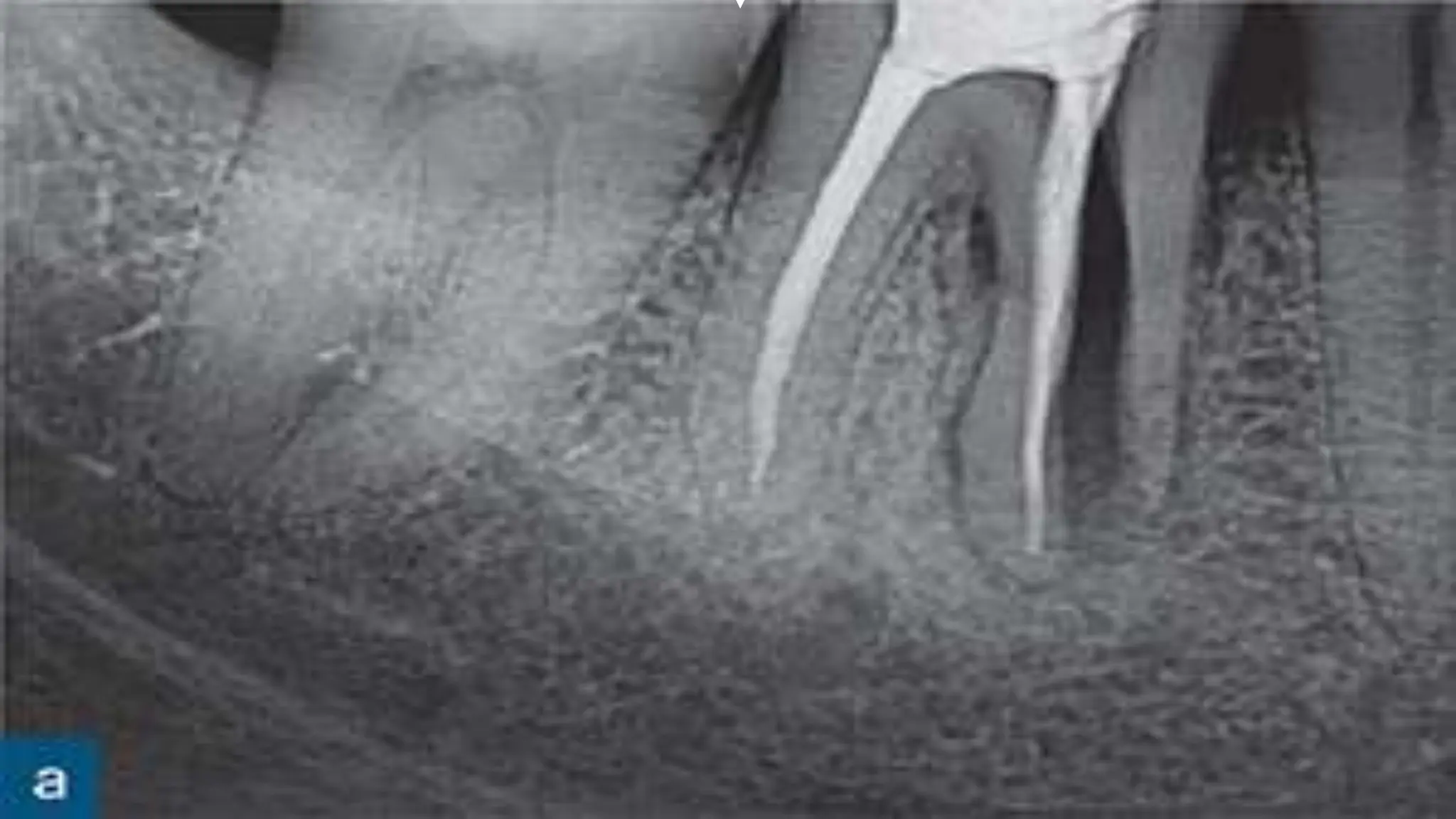 CBCT in dental trauma__.pptx explain dental trauma in cbct | PPTX