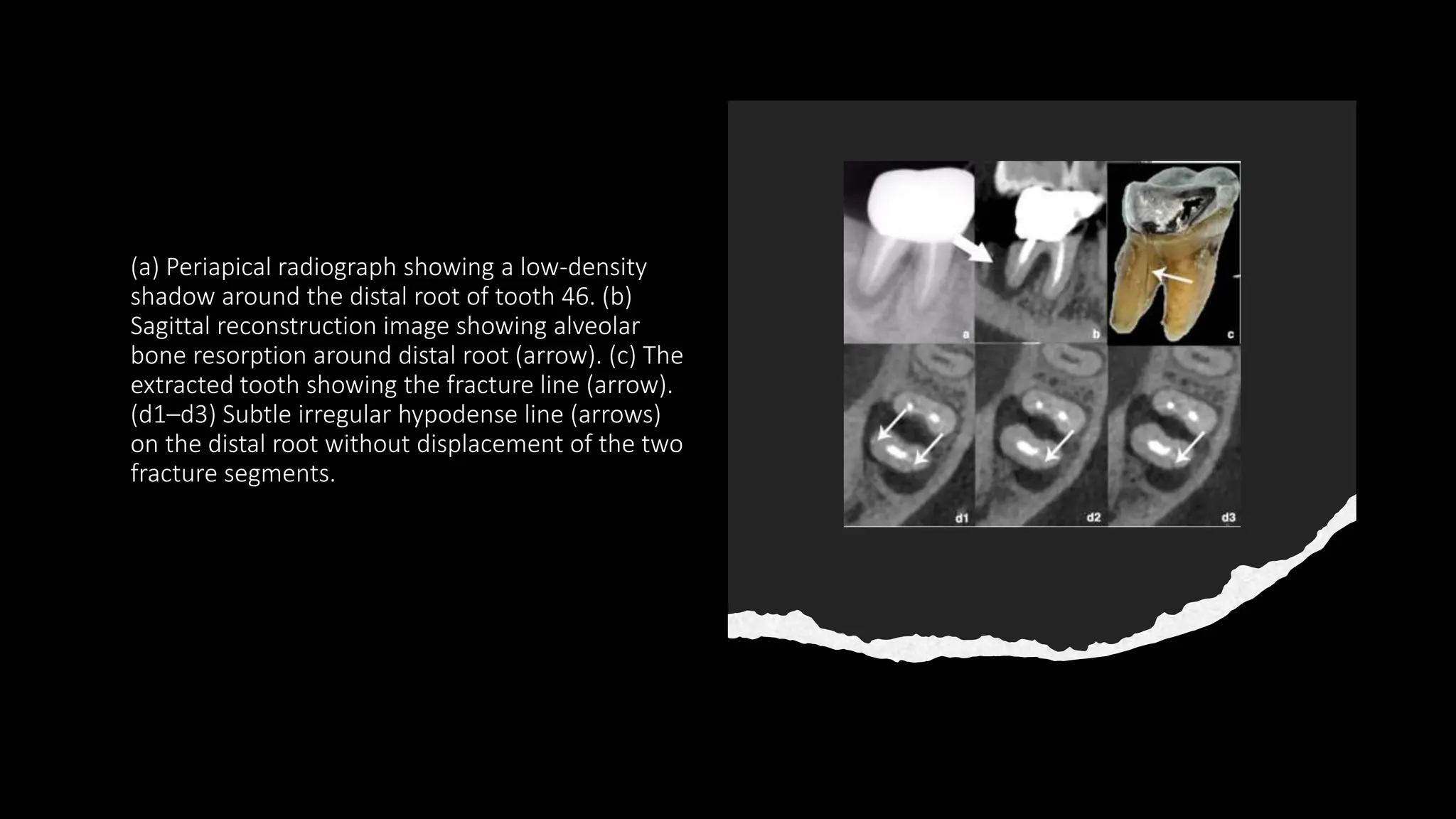 CBCT in dental trauma__.pptx explain dental trauma in cbct | PPTX