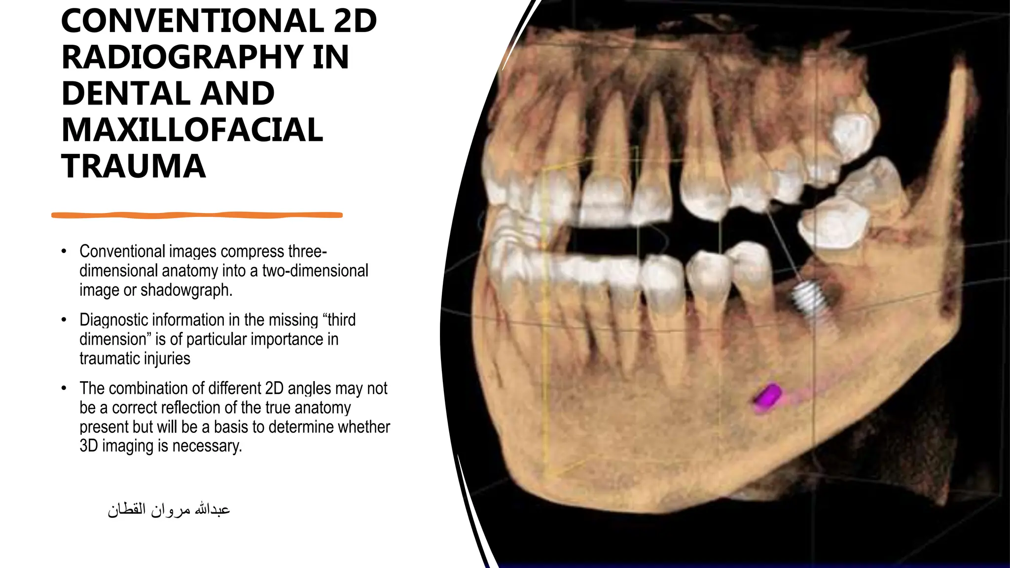 CBCT in dental trauma__.pptx explain dental trauma in cbct | PPTX