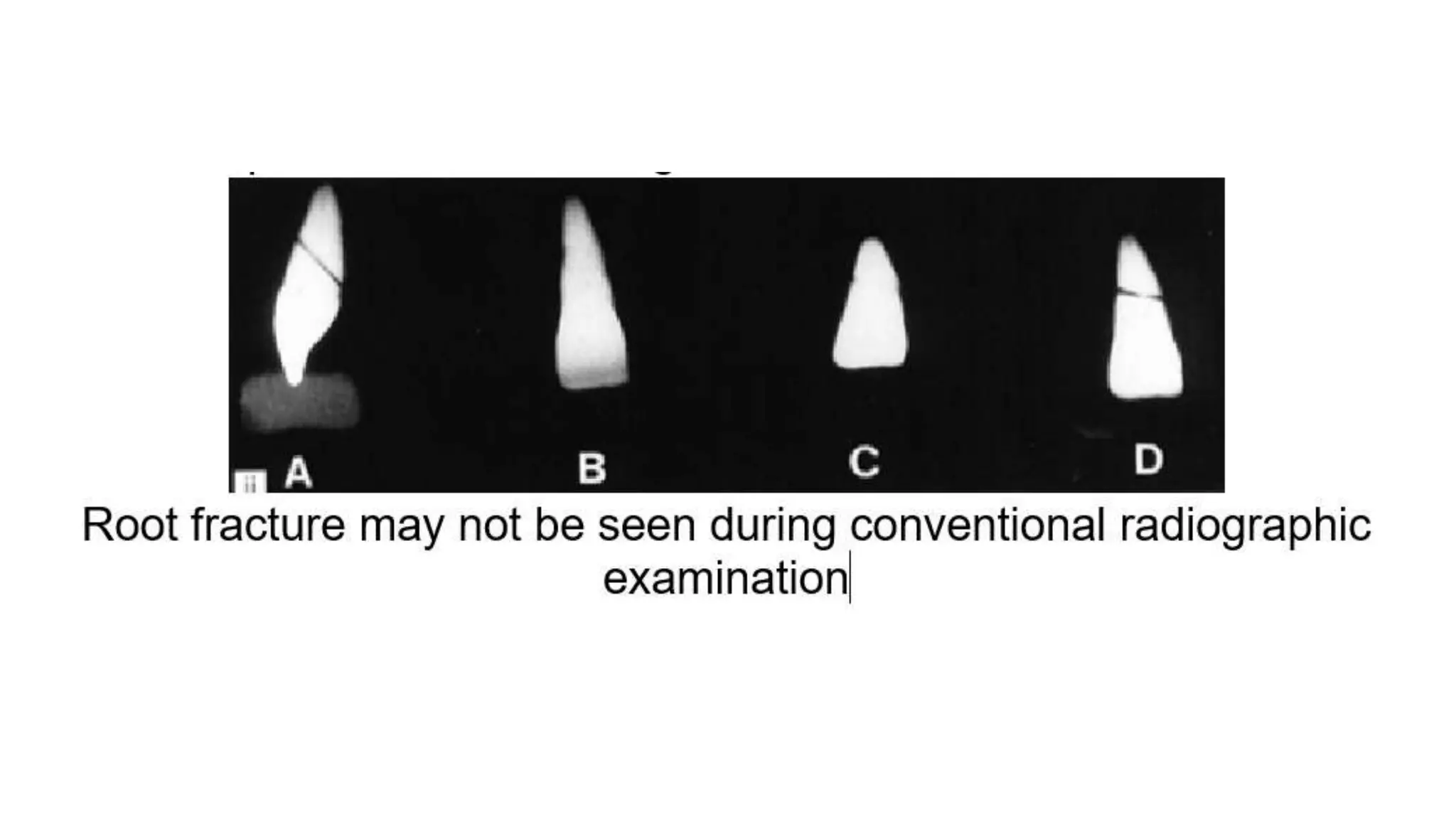 CBCT in dental trauma__.pptx explain dental trauma in cbct | PPTX
